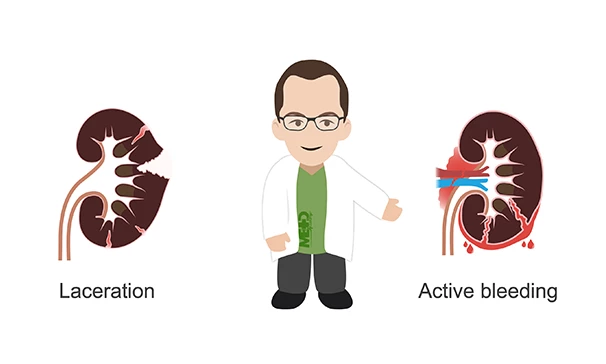 Abdominal CT Masterclass: Trauma - Identifying solid organ injury ...