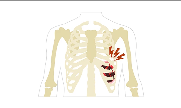 Abdominal CT Masterclass: Trauma - Spleen & liver injury | Medmastery