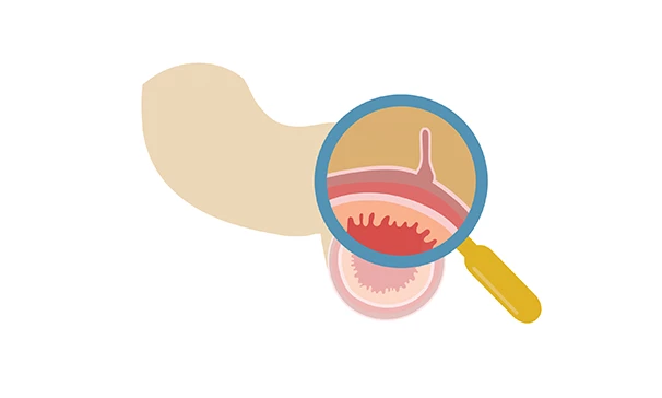 Abdominal CT Masterclass: Trauma - Bowel and mesenteric injury | Medmastery