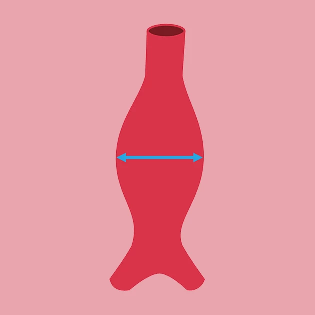 Identifying abdominal aortic dissections | Medmastery