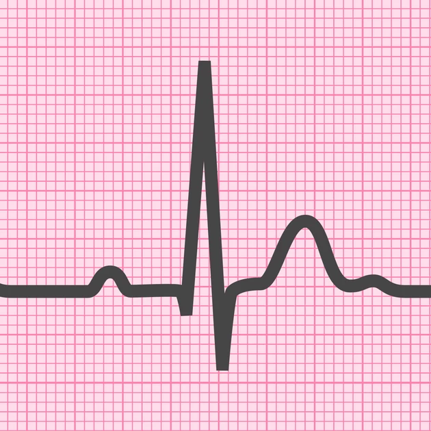 [UPDATE] ECG Mastery Yellow and Blue Belt courses | Medmastery