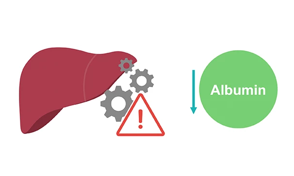 Getting to know albumin physiology | Medmastery