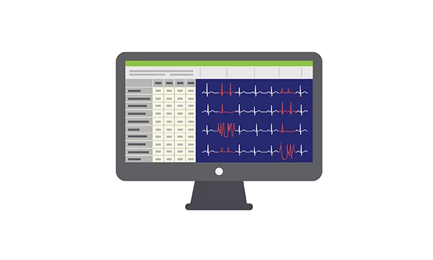 Reviewing the ECG of the Holter monitor | Medmastery