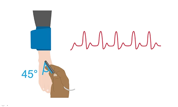 Performing a manual ankle-brachial index (ABI) | Medmastery