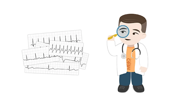 Making sense of common Holter ECG findings | Medmastery
