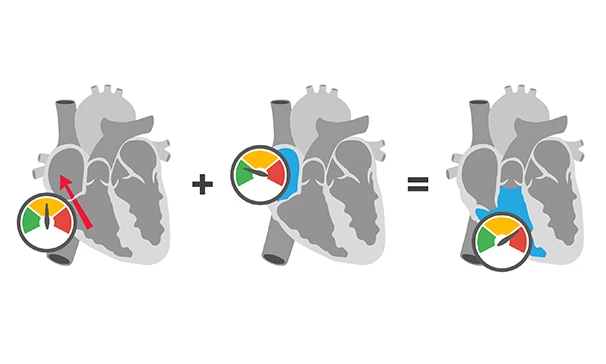 Inferring right-heart pressures with echocardiography using tricu ...