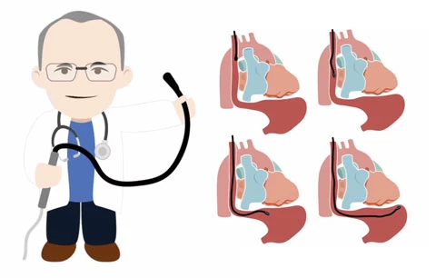 Mastering the most important TEE views | Medmastery