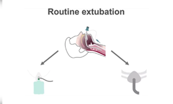 Applying NIV after extubation | Medmastery