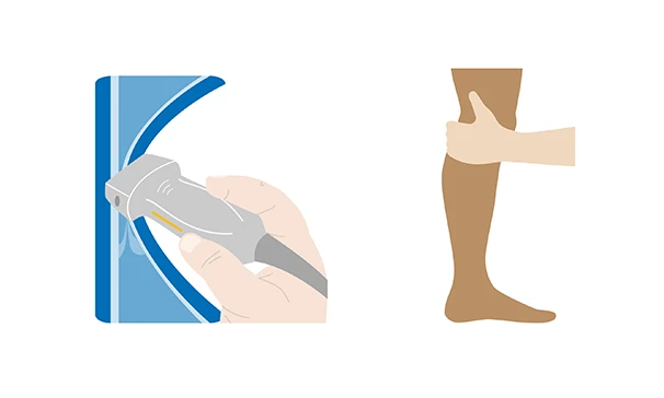 Venous ultrasound class: executing a DVT ultrasound study | Medmastery