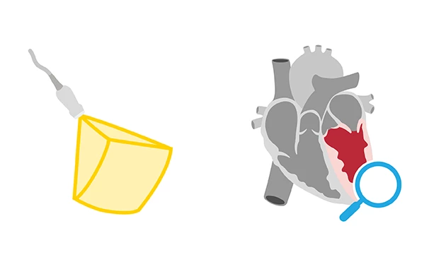 Analyzing the left ventricle using 3D echocardiography | Medmastery