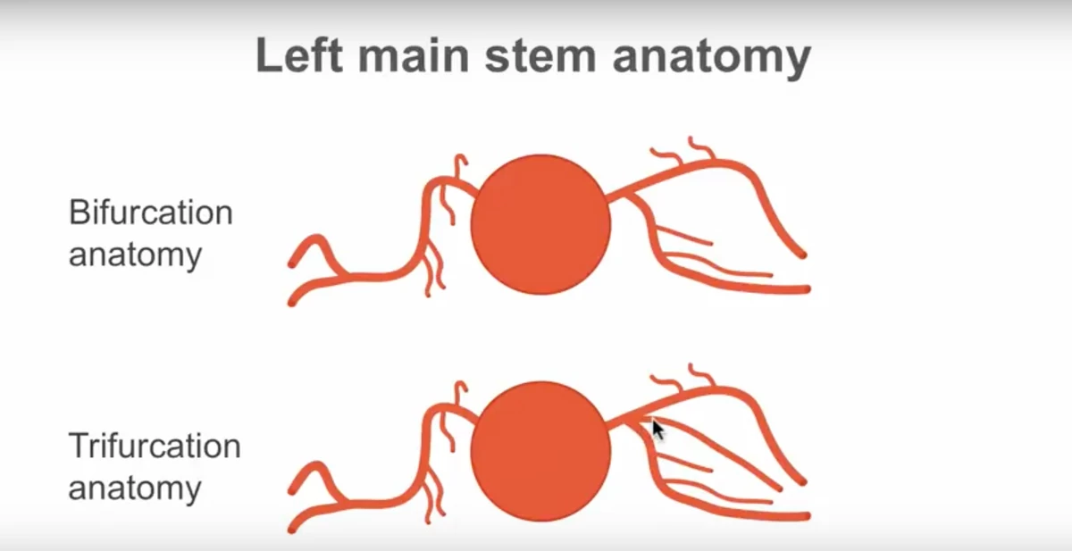 Finding the coronary artery origins using CT | Medmastery