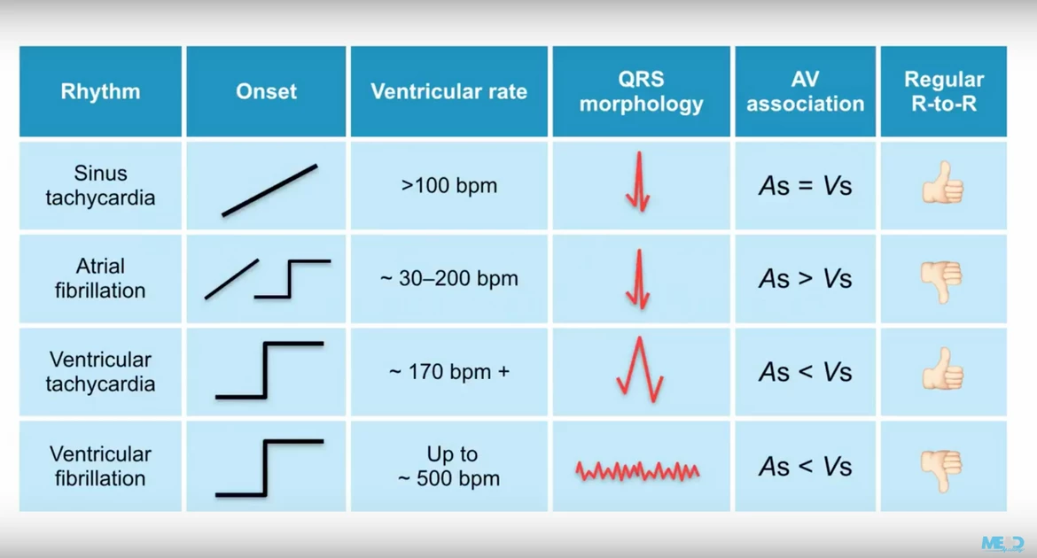 How to differentiate between different arrhythmias | Medmastery