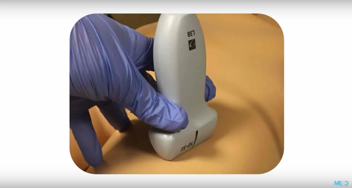 Using ultrasound to guide subcutaneous abscess drainage | Medmastery