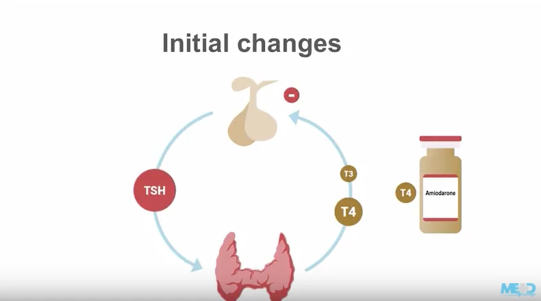 How amiodarone affects thyroid function | Medmastery