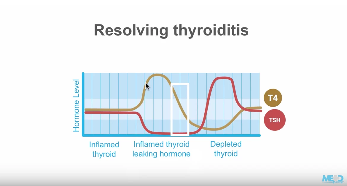 How to identify subclinical hyperthyroidism | Medmastery