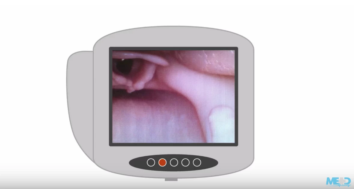 Mastering video laryngoscopy | Medmastery