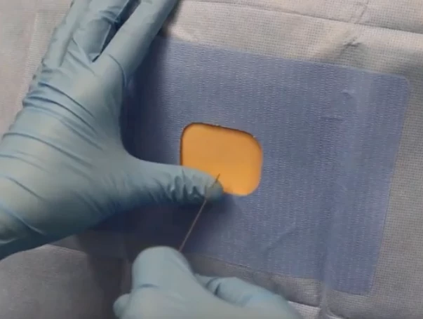 How to do a lumbar puncture | Medmastery