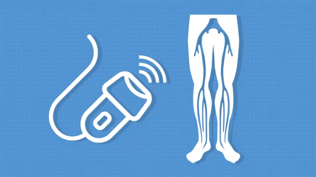 Ultrasound Clinical Guide: Arteries of the Legs | Medmastery