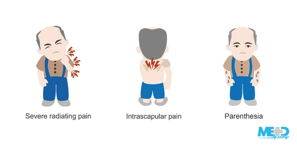 Cervical Radiculopathy Patterns Classification Criteria For Cervical