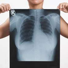 Getting into the chest x-ray (part 1): The importance of grayscal ...