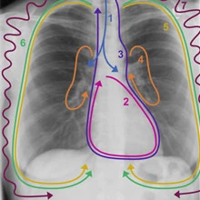 Medmastery’s chest x-ray algorithm—a systematic approach for | Medmastery